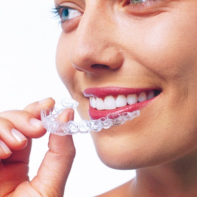 invisalign-invisible-braces-vadodara - Dental Spa Vadodara